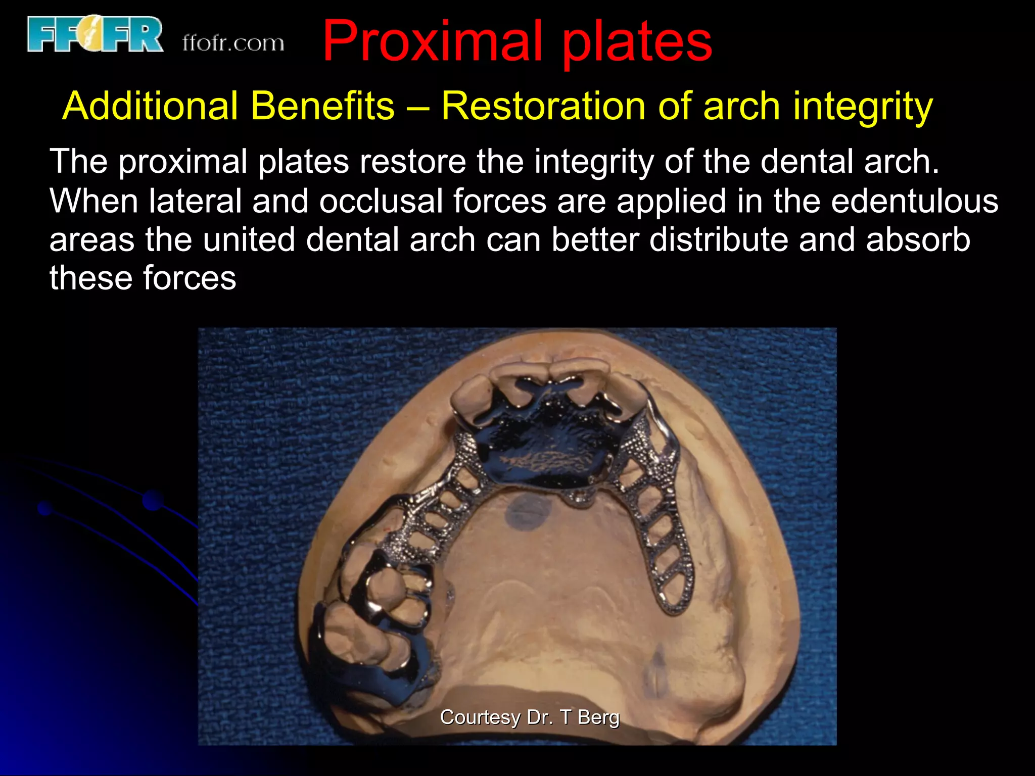 Tooth tissue junction, major and minor connectors | PPT