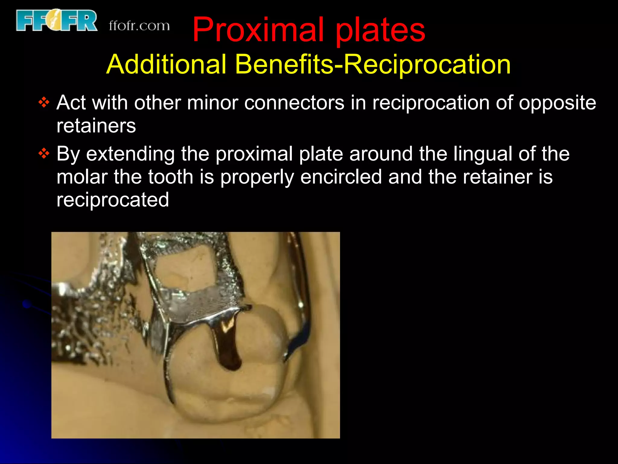 Tooth tissue junction, major and minor connectors | PPT