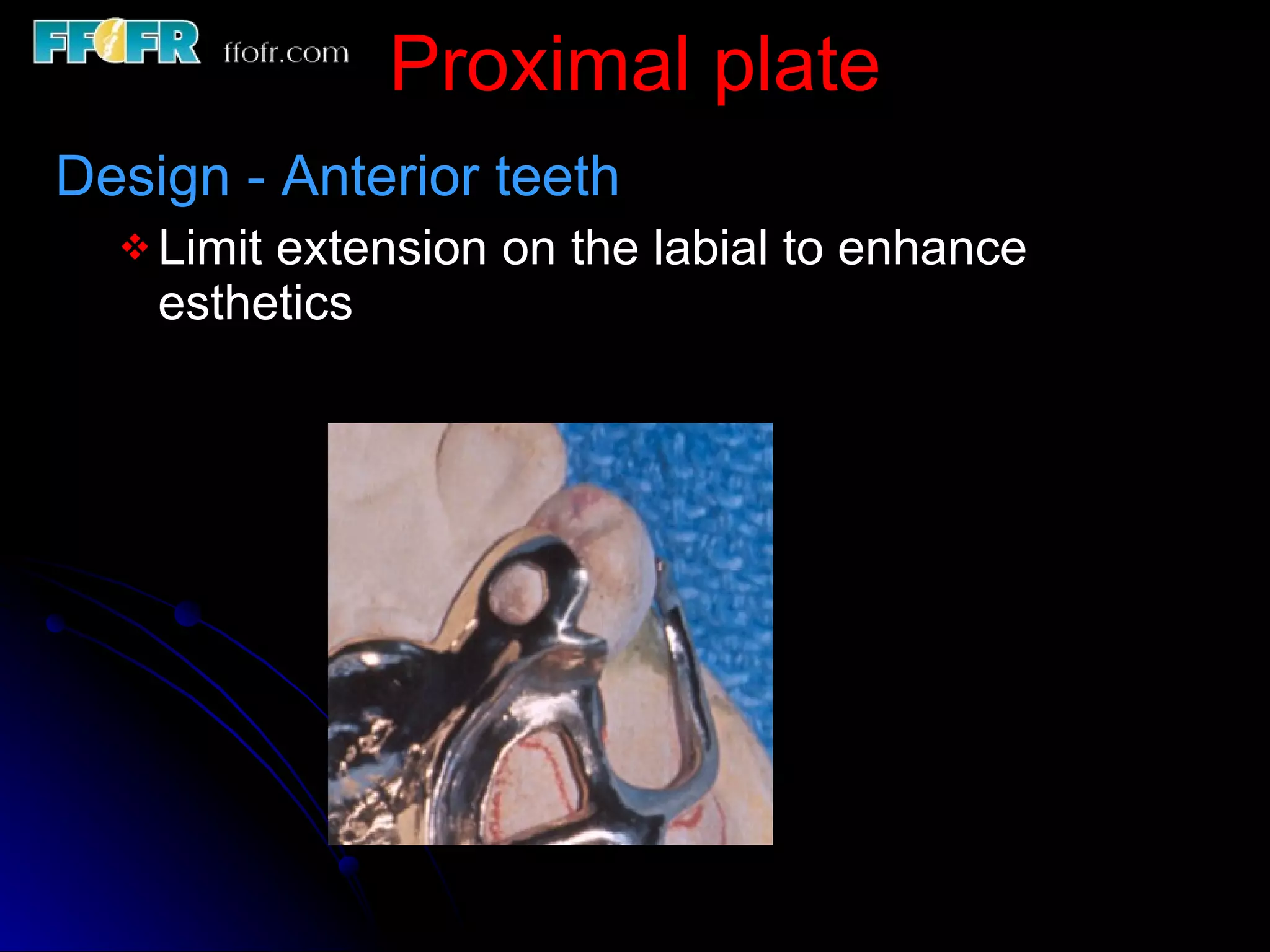 Tooth tissue junction, major and minor connectors | PPT