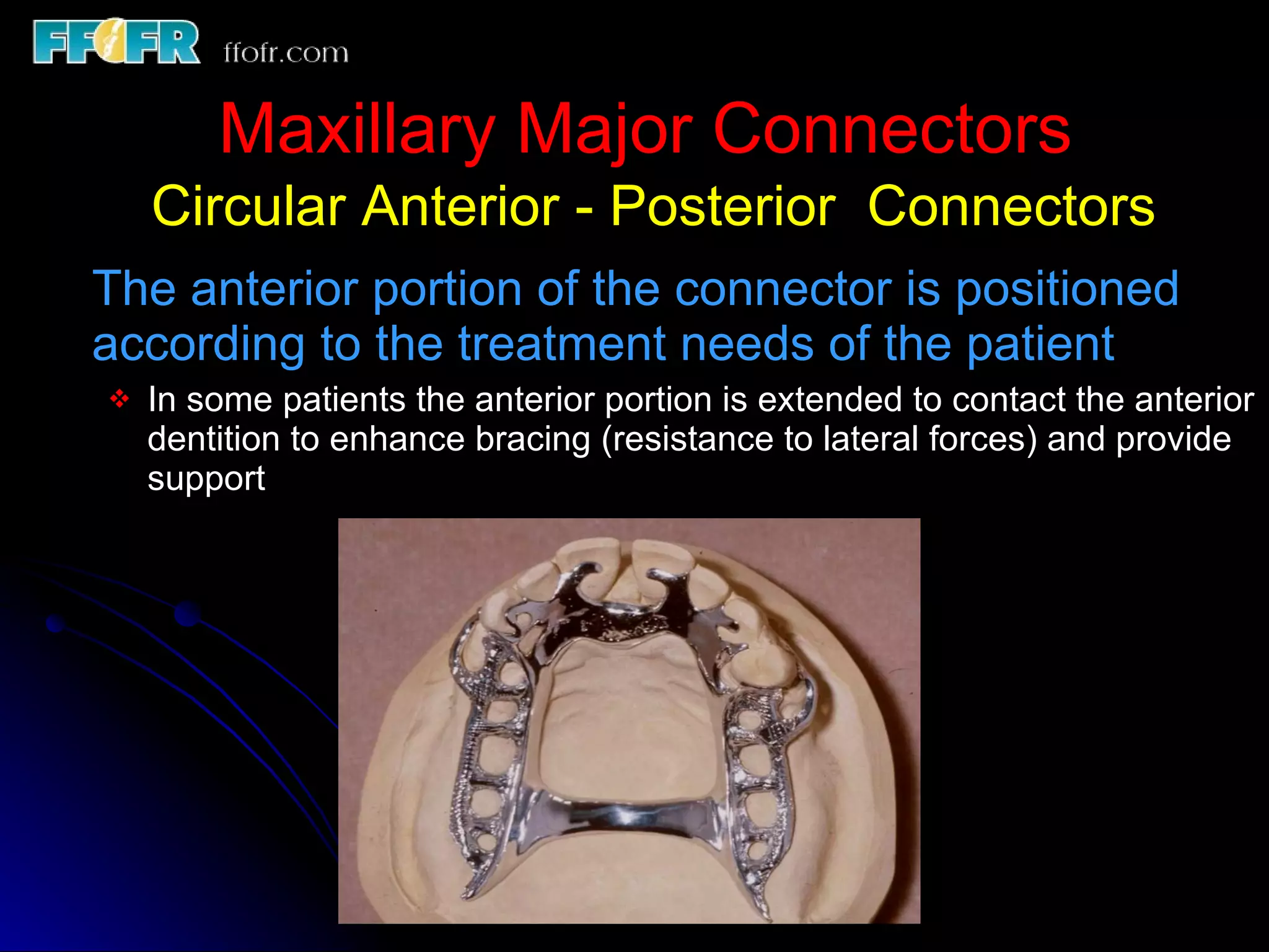 Tooth tissue junction, major and minor connectors | PPT