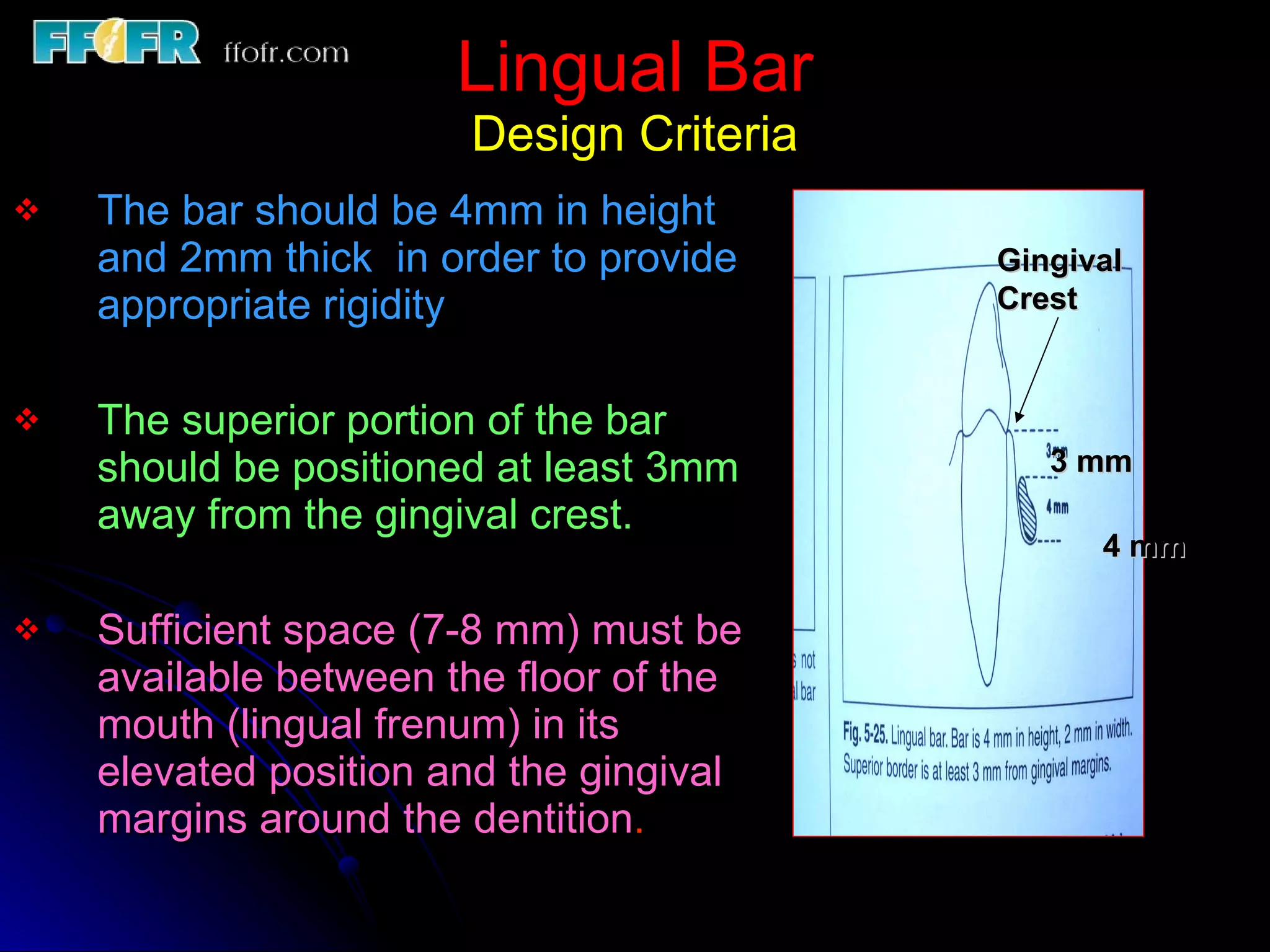 Tooth tissue junction, major and minor connectors | PPT