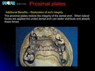 Tooth tissue junction, major and minor connectors | PPT