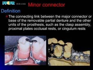 Tooth tissue junction, major and minor connectors | PPT