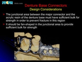 Tooth tissue junction, major and minor connectors | PPT