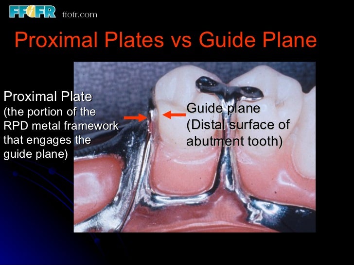 Tooth tissue junction, major and minor connectors