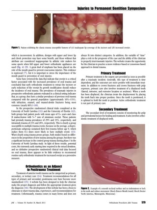 Orthodontic Procedures after Trauma, Injuries to Permanent Dentition | PDF