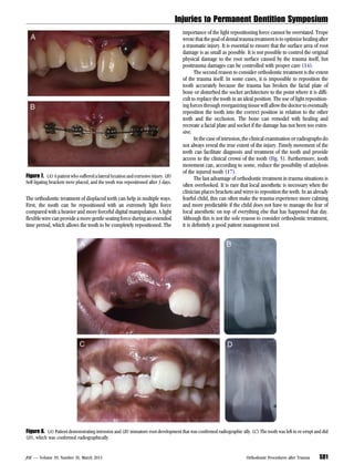 Orthodontic Procedures after Trauma, Injuries to Permanent Dentition | PDF