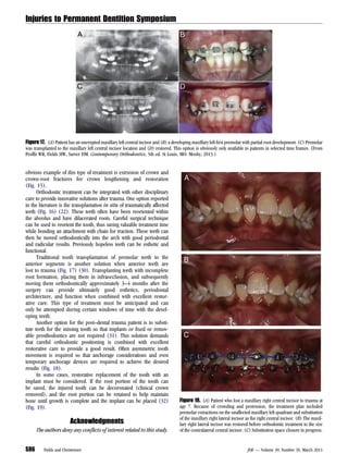 Orthodontic Procedures after Trauma, Injuries to Permanent Dentition | PDF