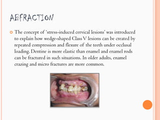 Tooth wear and its types | PPTX