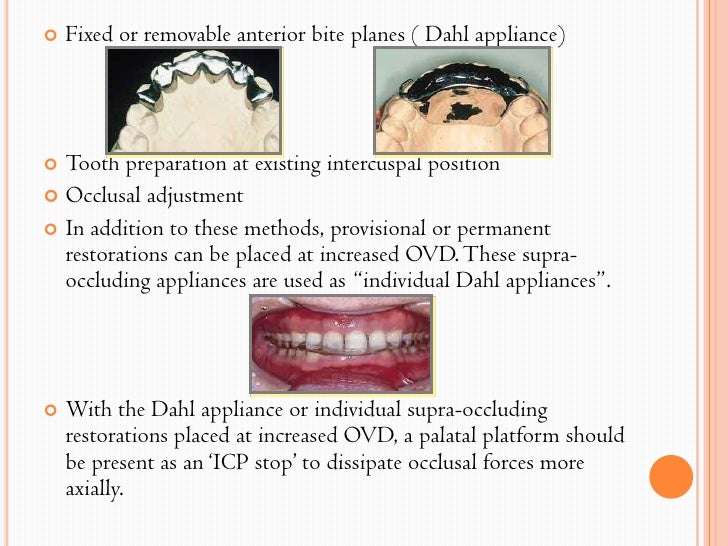 Tooth wear and its types