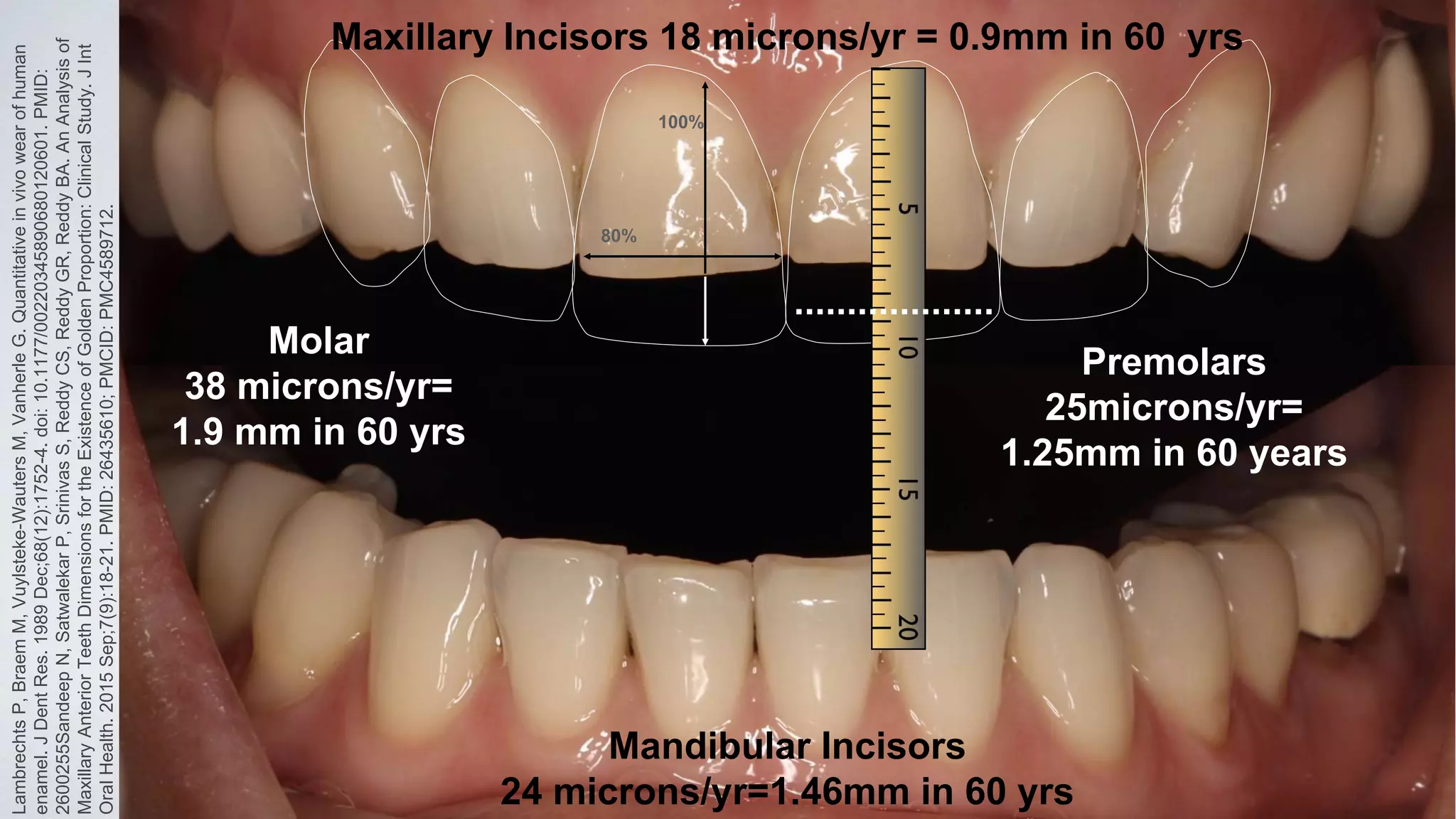Tooth Wear Management - Why, When, What, How?.pptx