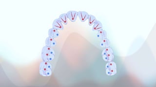 Tooth Wear Management - Why, When, What, How?.pptx