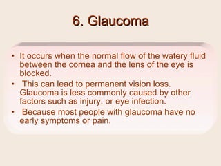 Top 10 Eye Related Problems | PPT