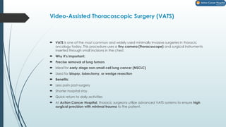 Top 7 Minimally Invasive Surgeries in Thoracic Oncology You Should Know ...