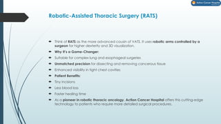 Top 7 Minimally Invasive Surgeries in Thoracic Oncology You Should Know ...