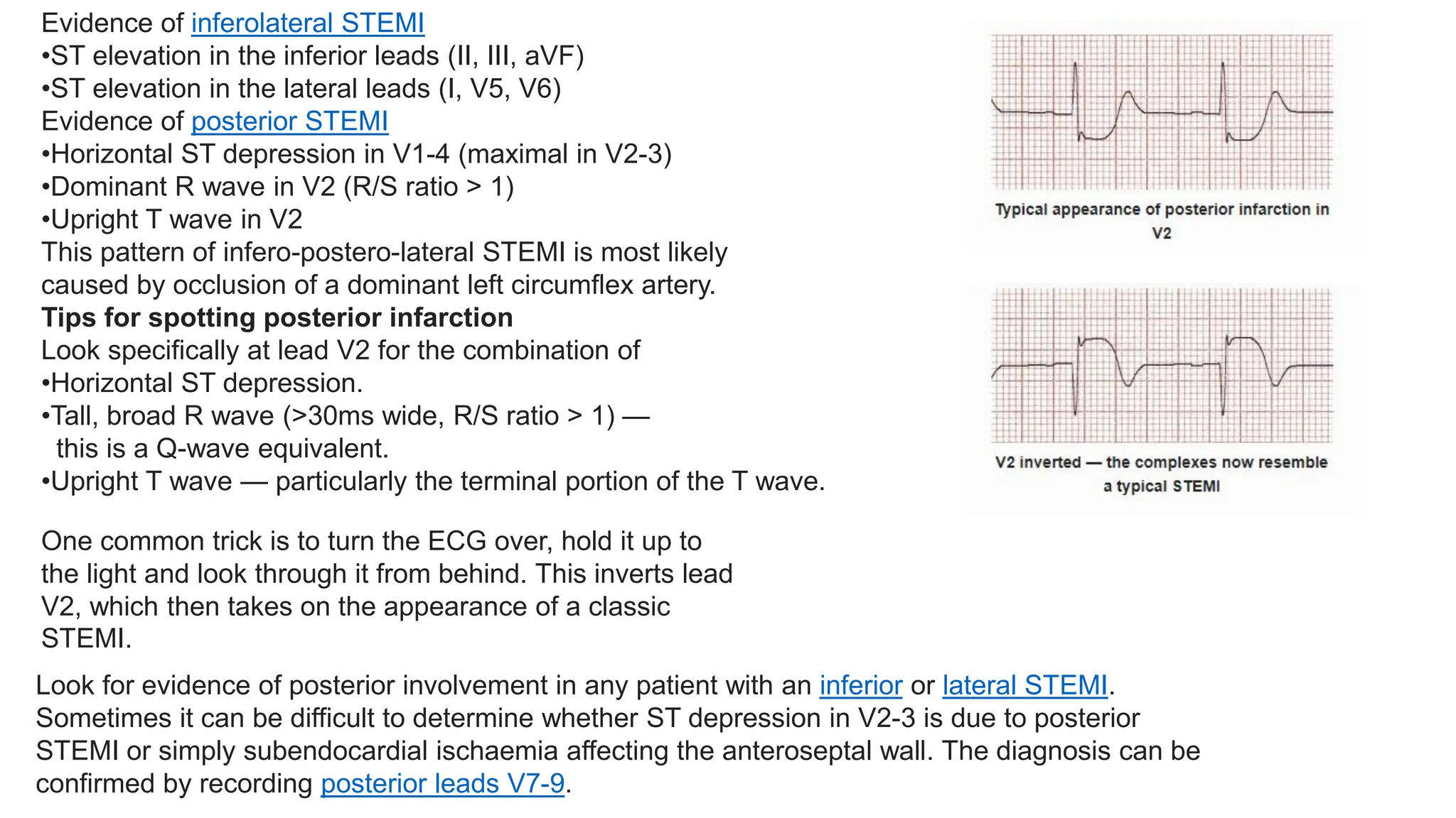 Top100 ECG cases anilkumarhhhhhhhhhhbvfv.pdf
