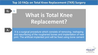 10 Frequently Asked Questions (FAQs) on Total Knee Replacement Surgery ...