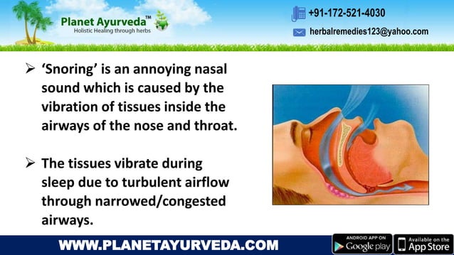Top 10 Home Remedies for Snoring | Planet Ayurveda | PPT