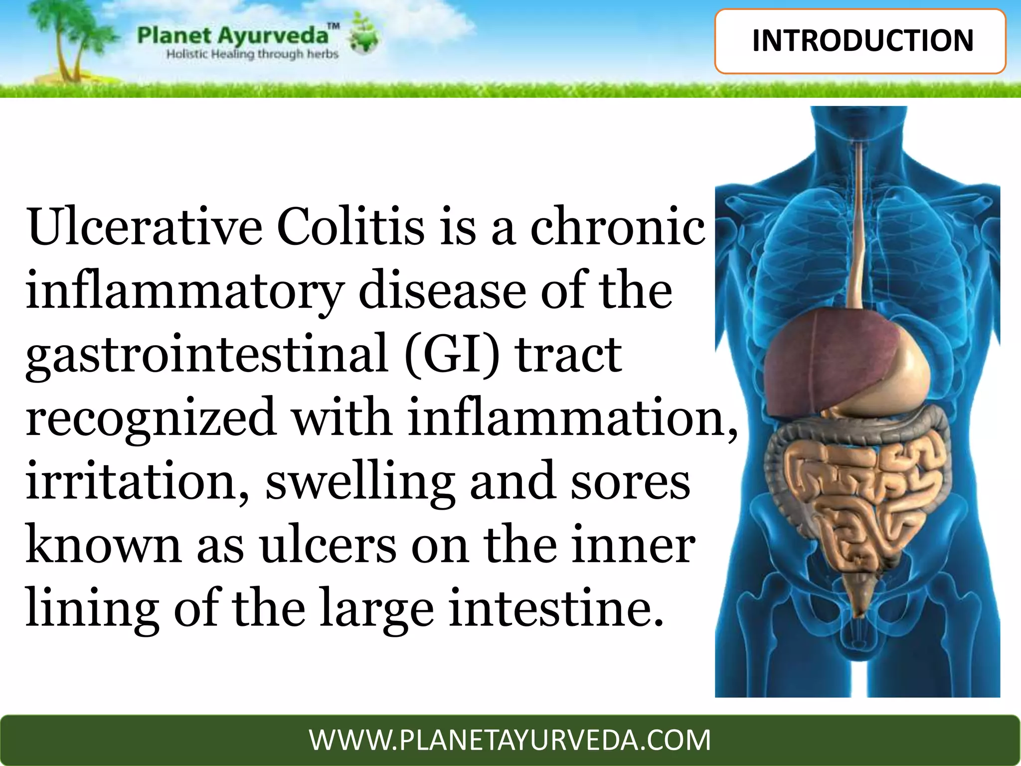 Top 10 home remedies for ulcerative colitis | Manage at Home | PPTX