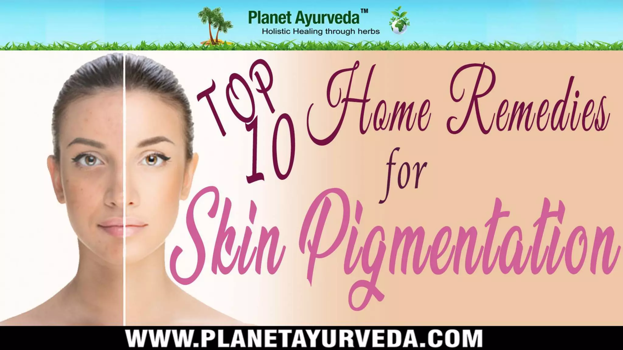 Top 10 Home Remedies To Get Rid Of Skin Pigmentation | PPTX