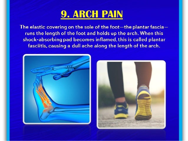 Top 10 Most Common Sports Injuries Infographic