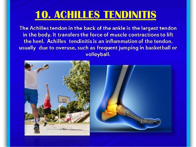 Top 10 Most Common Sports Injuries Infographic