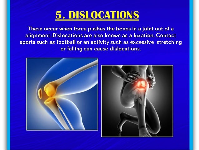 Top 10 Most Common Sports Injuries Infographic