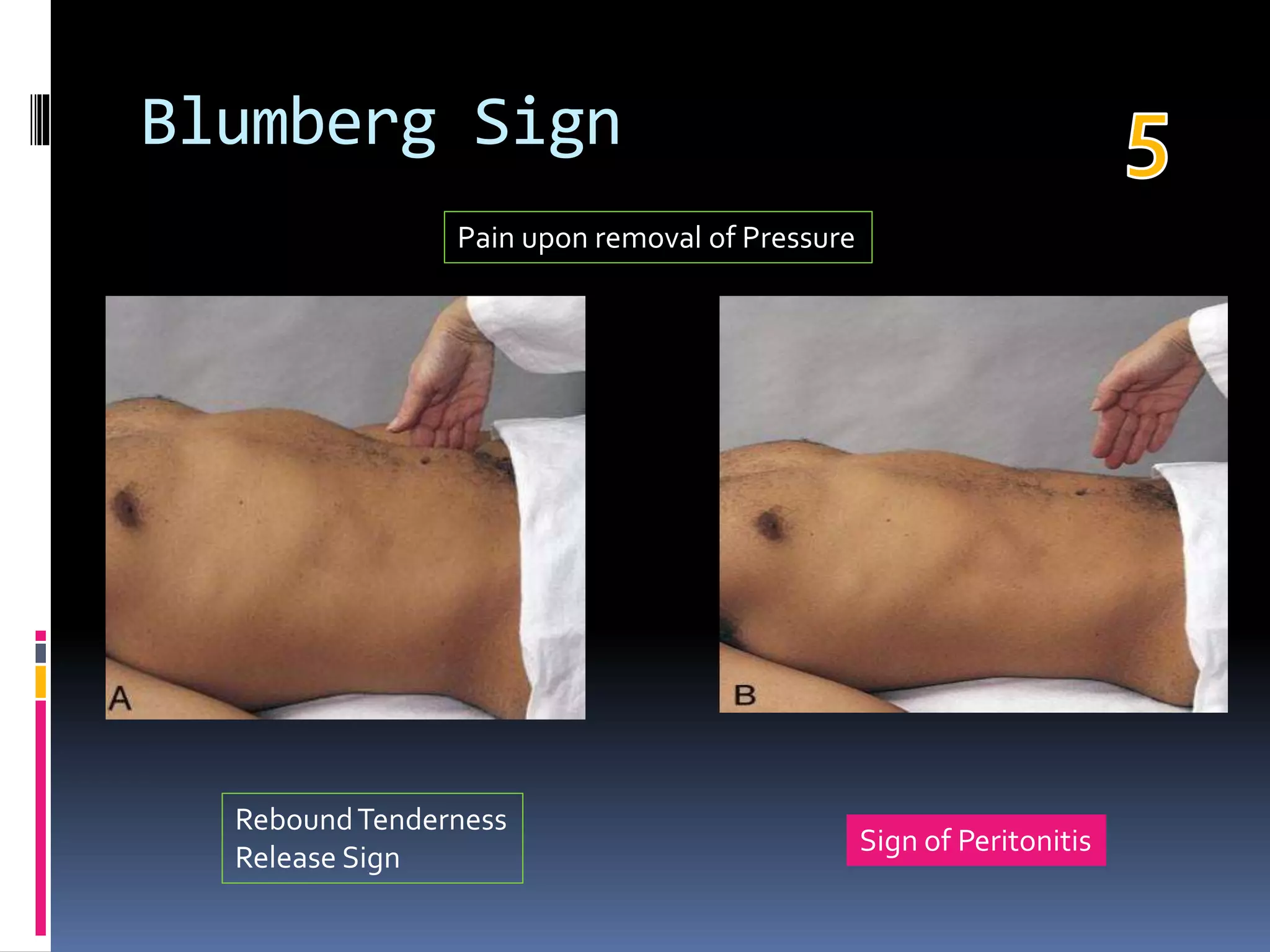 Top 10 signs in gastroenterology | PPTX