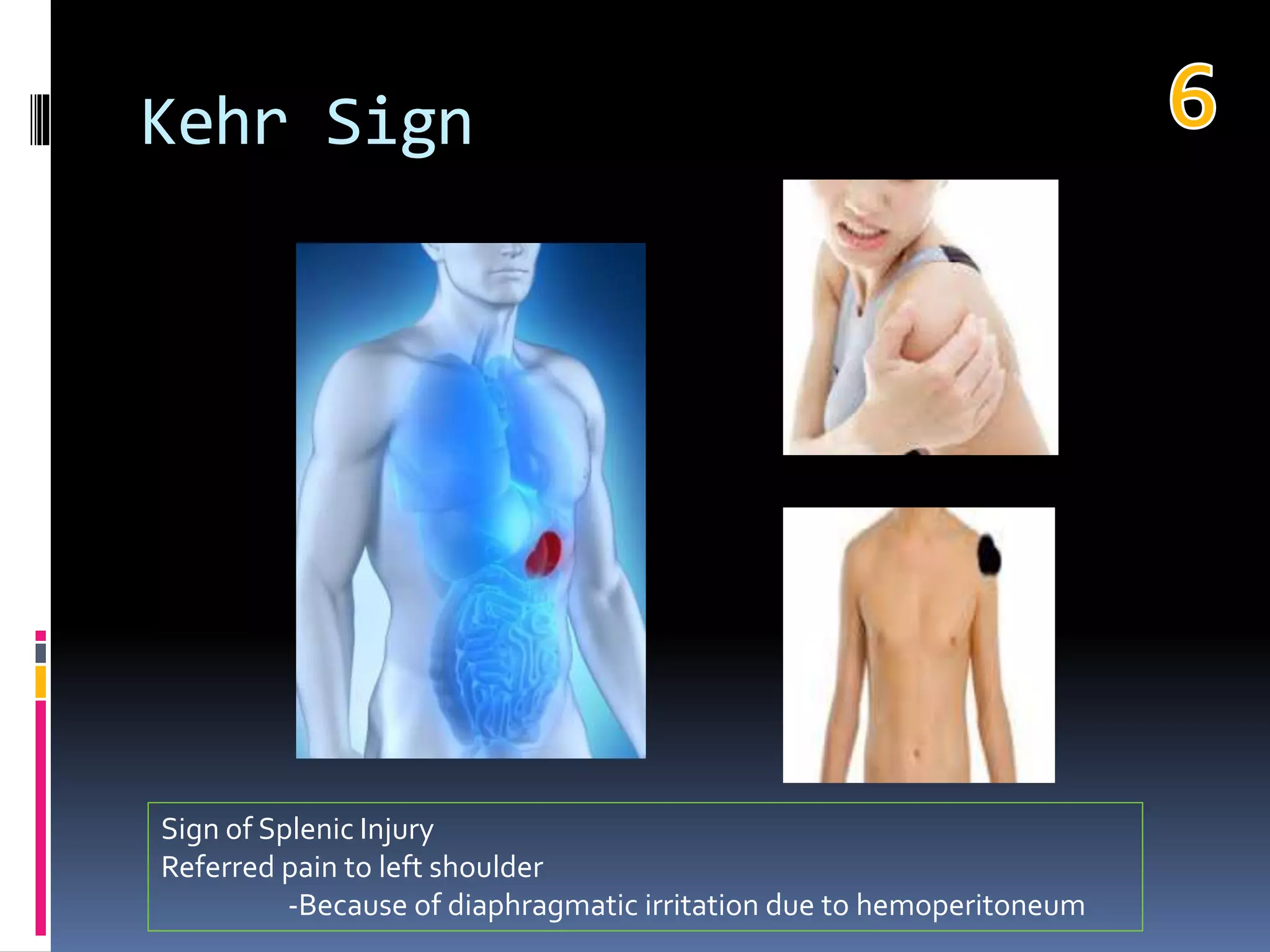 Top 10 signs in gastroenterology | PPTX