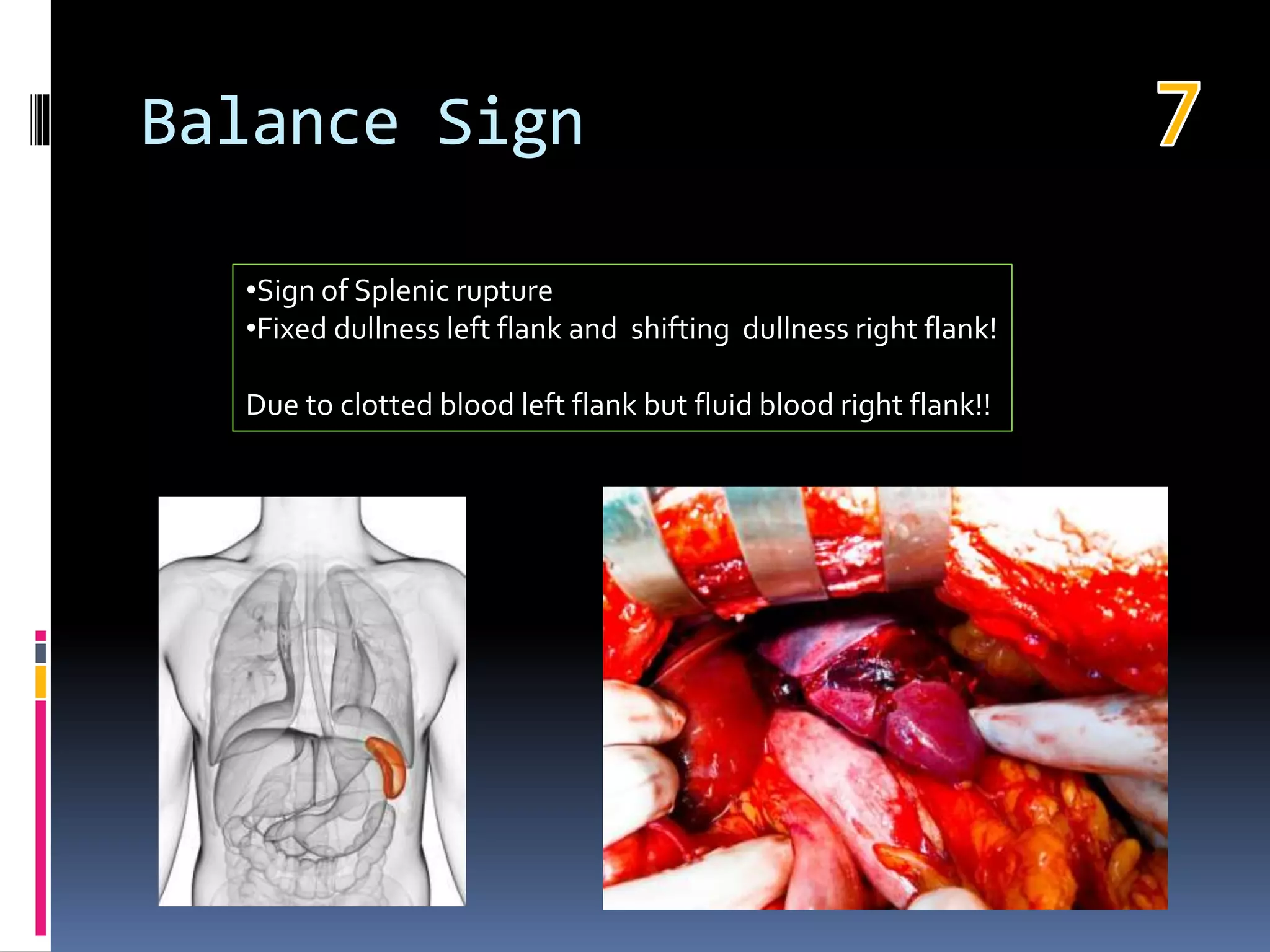 Top 10 signs in gastroenterology | PPTX