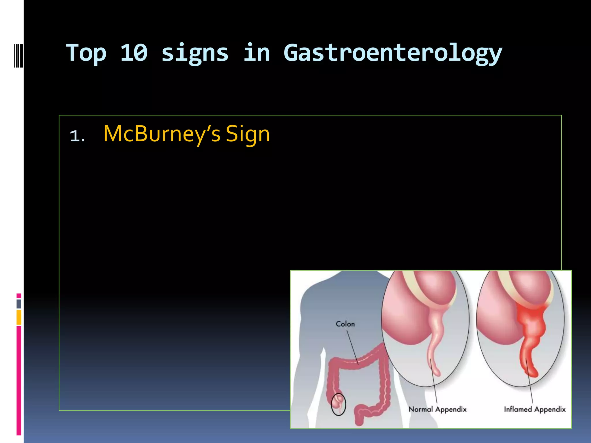 Top 10 signs in gastroenterology | PPTX