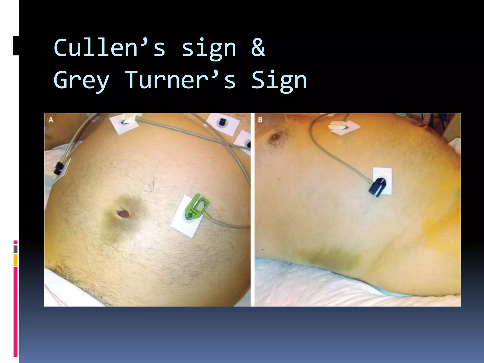 Top 10 signs in gastroenterology