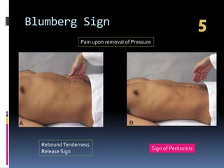 Top 10 signs in gastroenterology | PPT