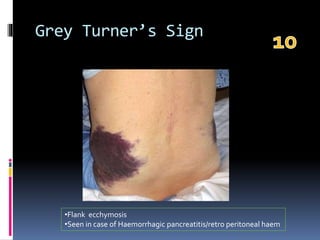 Grey Turners Sign
