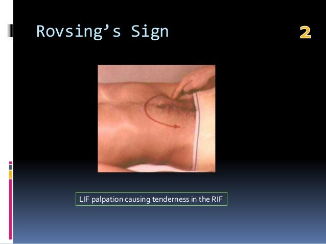 Top 10 signs in gastroenterology