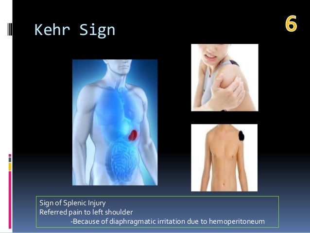 Top 10 signs in gastroenterology