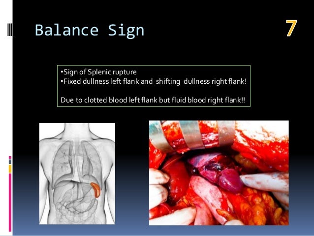 Top 10 signs in gastroenterology