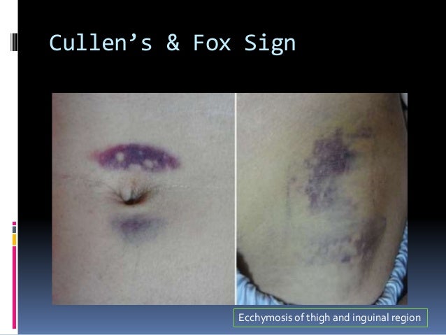 Top 10 signs in gastroenterology