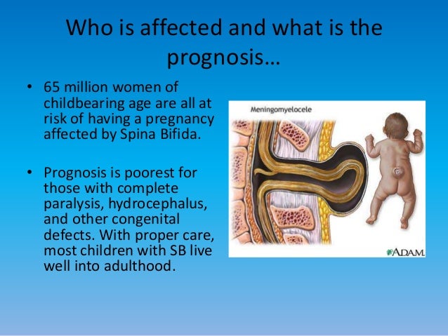 Top 3 Causes And Symptoms Of Spina Bifida