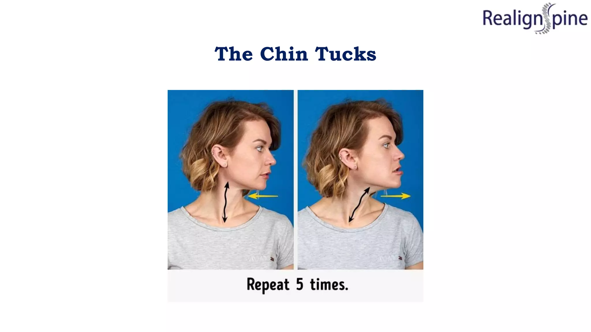 Top 4 Cervical Disc Herniation Exercises That Help Relieve Pain | PPT