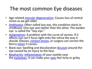 Top Causes of Eye Problems.pptx