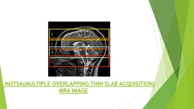 magnetic resonance in angiography | PPTX | Blood Disorders | Diseases ...