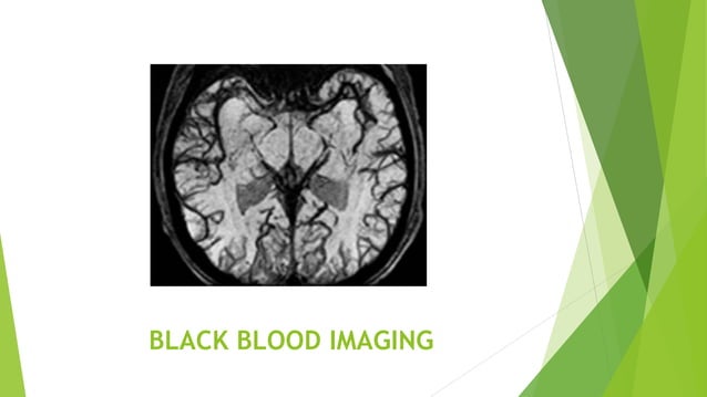 magnetic resonance in angiography | PPTX | Blood Disorders | Diseases ...