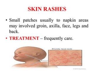 Topic minor disorders of the newborn | PPTX