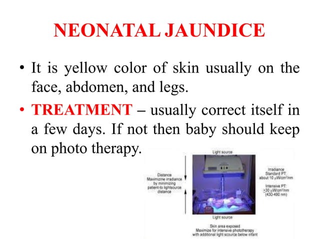 Topic Minor Disorders Of The Newborn Ppt