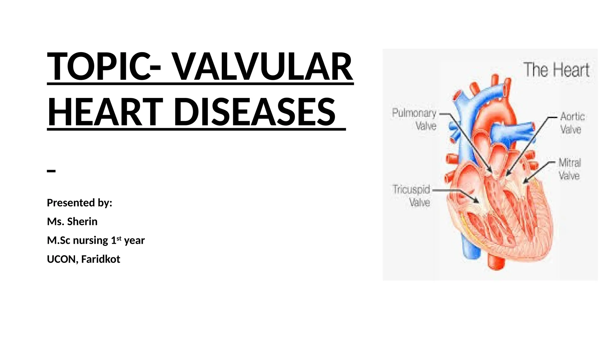 TOPIC OF PRESENTATION- VALVULAR HEART DISEASES.pptx