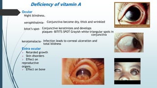 Topic vitamin a | PPT