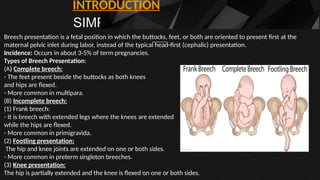 Breech presentation of the fetus……………….. | PPTX