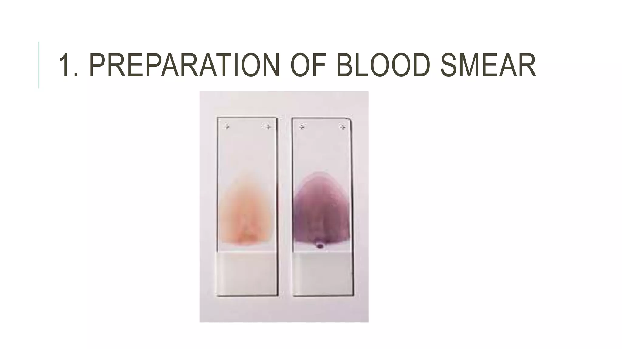 TOPIC 10 ROMANOWSKY STAINING.pptx