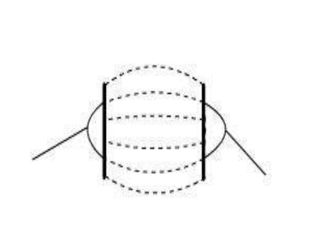 SWD (Short wave diathermy)- Physiotherapy.ppt